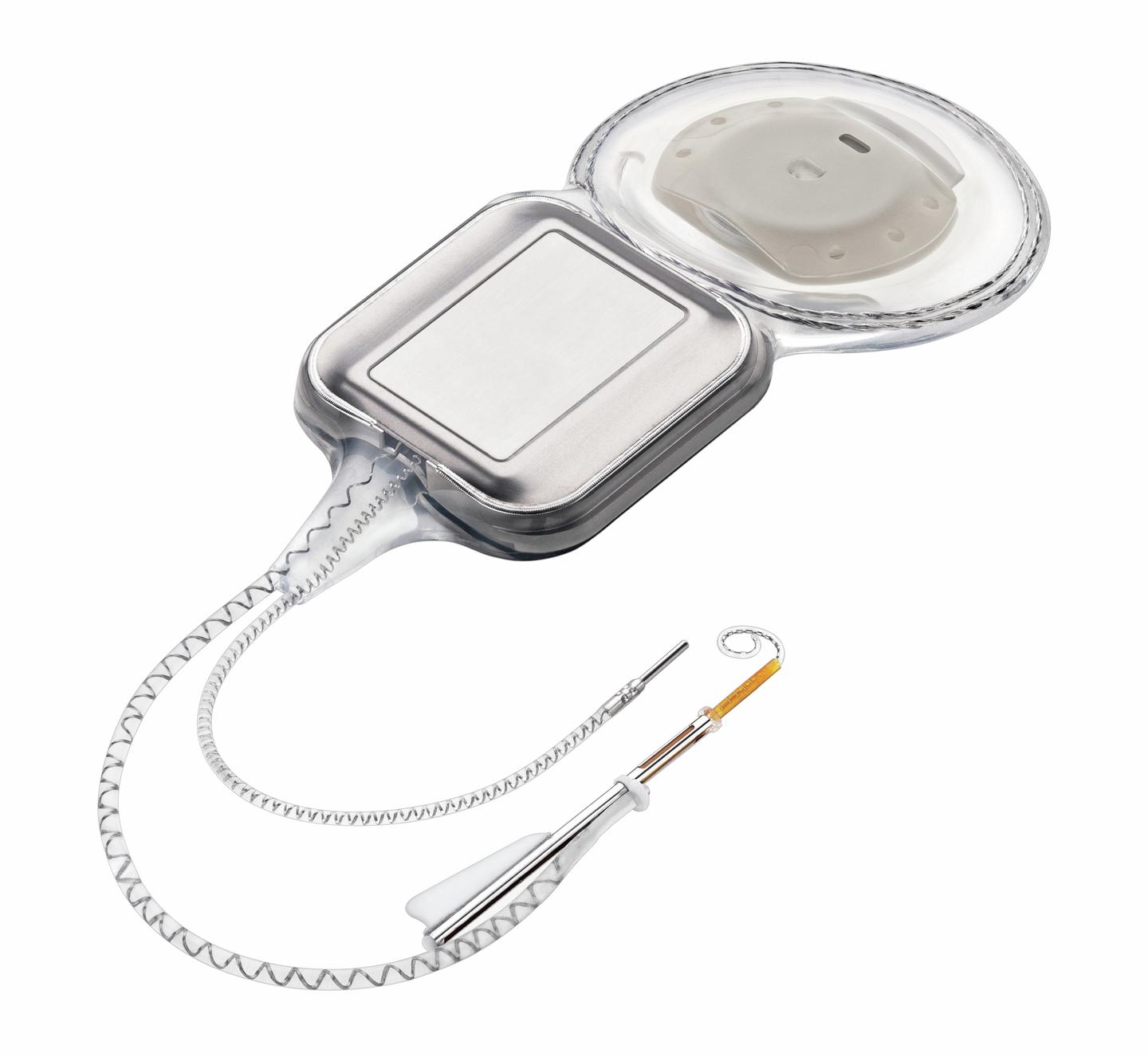 Nucleus® Implantate