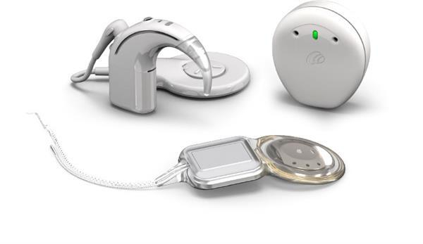 Cochlear Launches Nucleus® Nexa® System and Baha® 7 Sound Processor ...